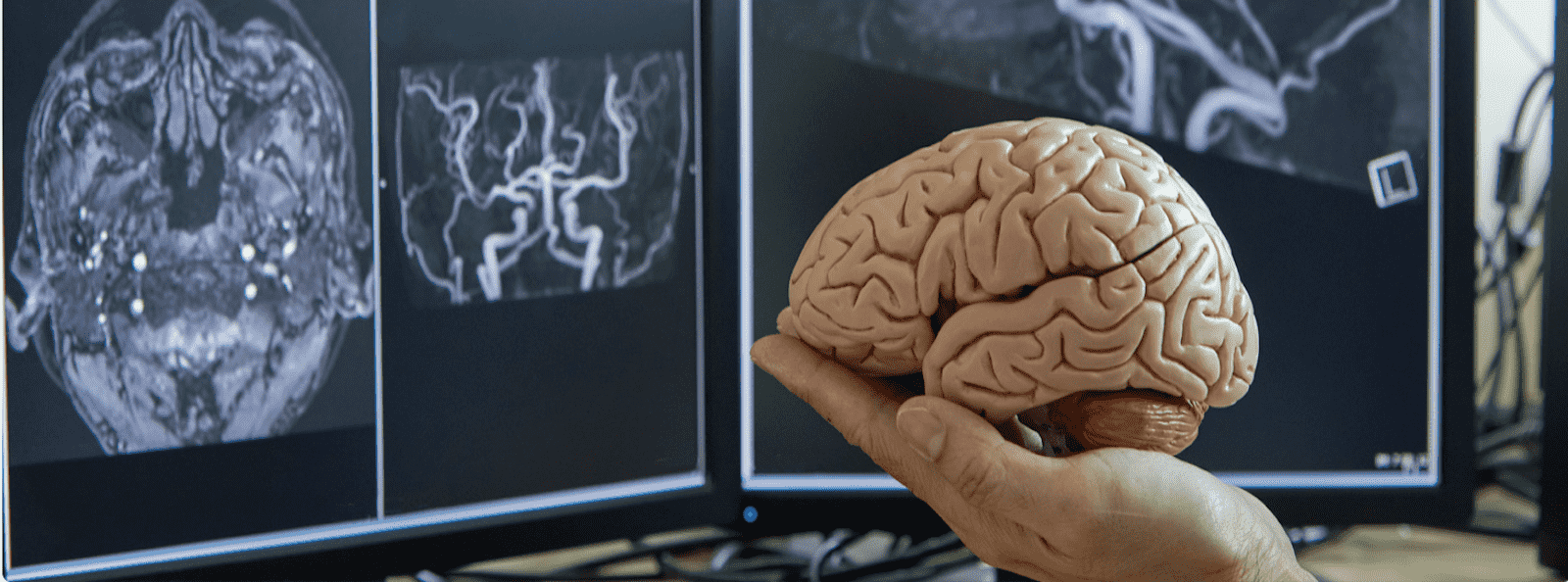 GOÄ: Abrechnungen neurologischer und körperlicher Untersuchungen nach ...